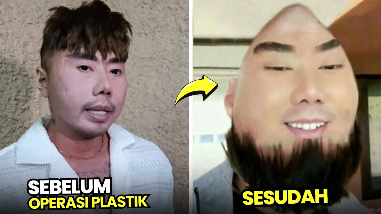 MUKA 99% PLASTIK, 8 Artis PRIA Lakukan operasi plastik di akhir tahun ...