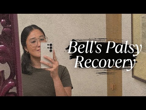 Bell's Palsy Recovery - YouTube