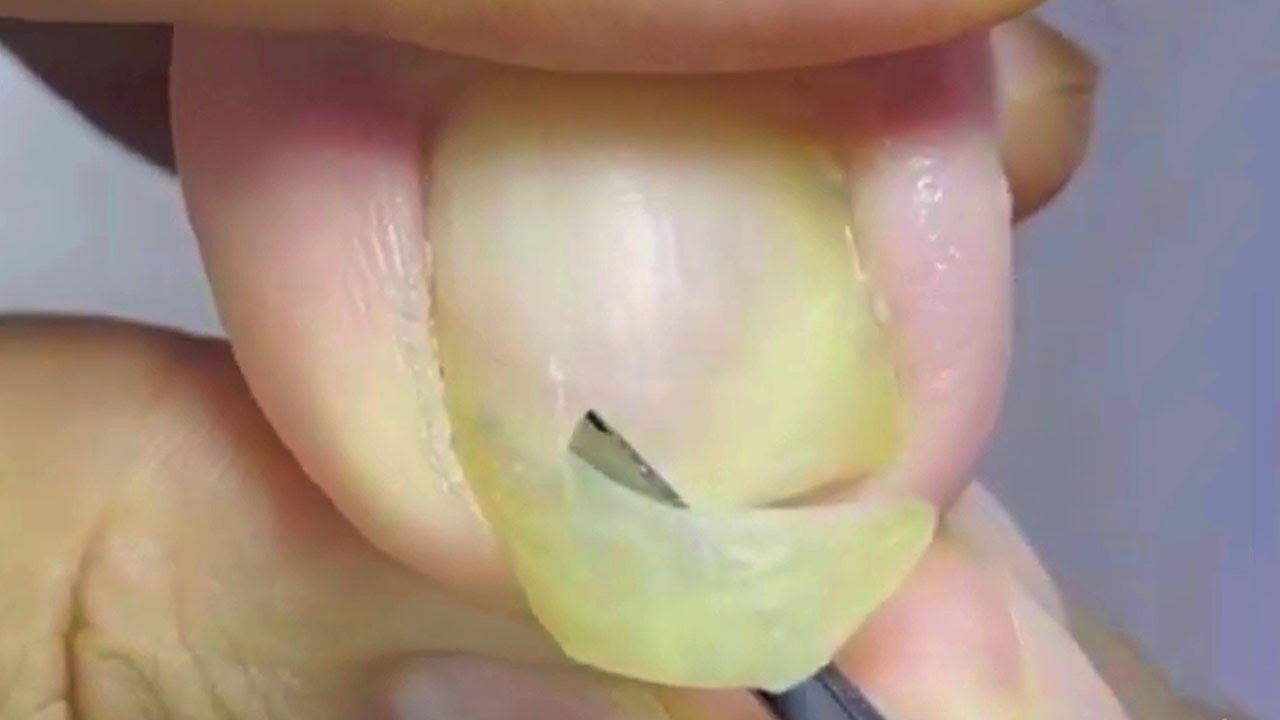 Nails That Have Never Been Trimmed For More Than Two Months, The ...