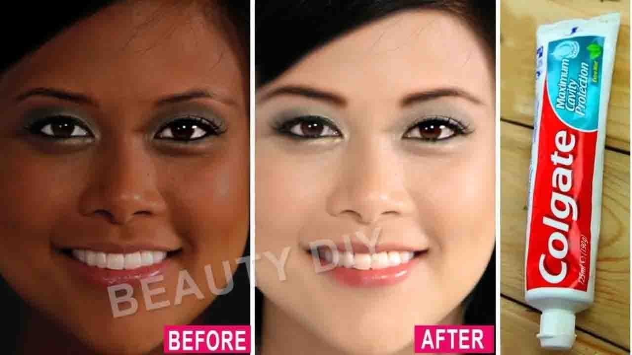 I Applied Toothpaste On My Skin & See What Happened - YouTube