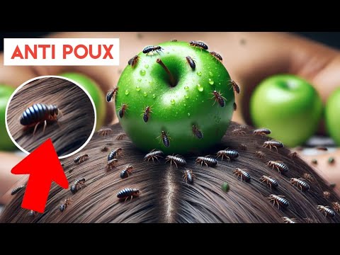 "Des Milliers de Poux dans ses Cheveux… La Solution Choc Révélée ...