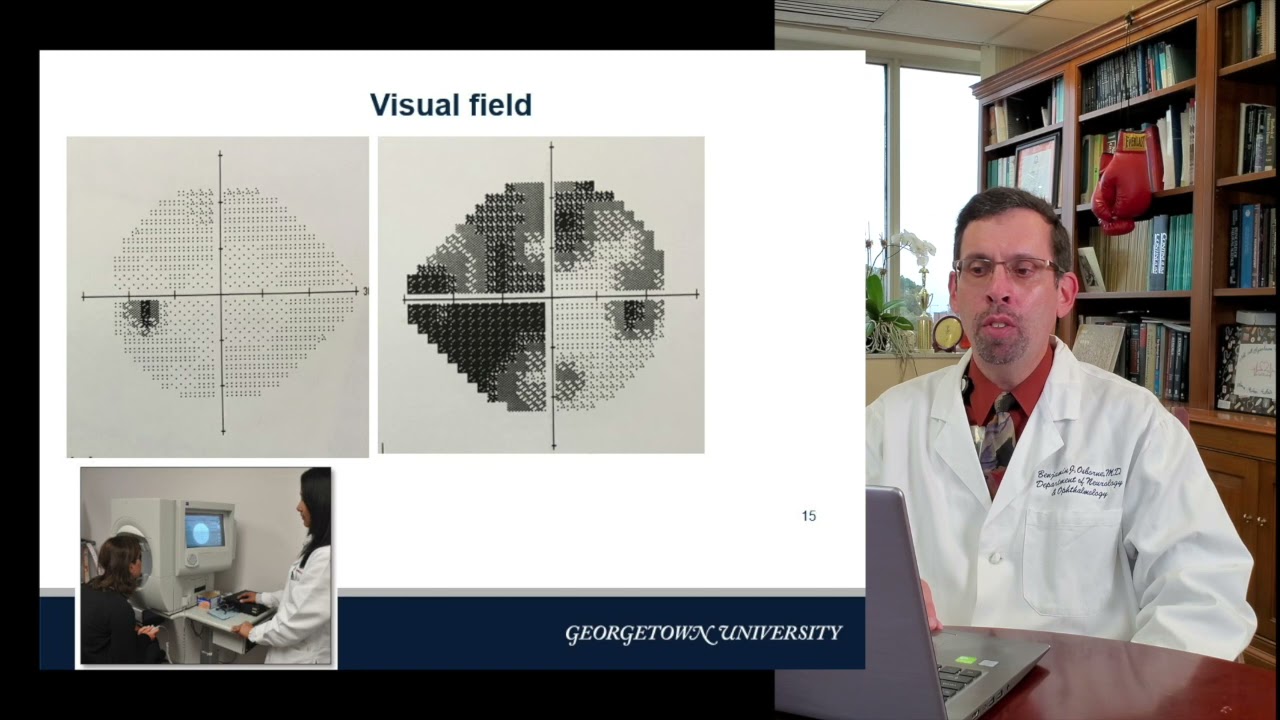 MS 101: "Visual Disturbances in MS" by Dr. Benjamin Osborne, 2021 - YouTube