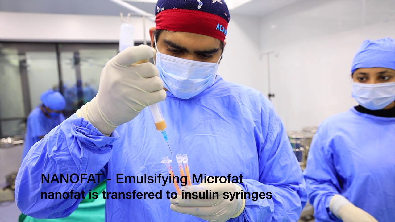 Autologous Microfat and Nanofat Grafting for Treating Acne Scars - YouTube