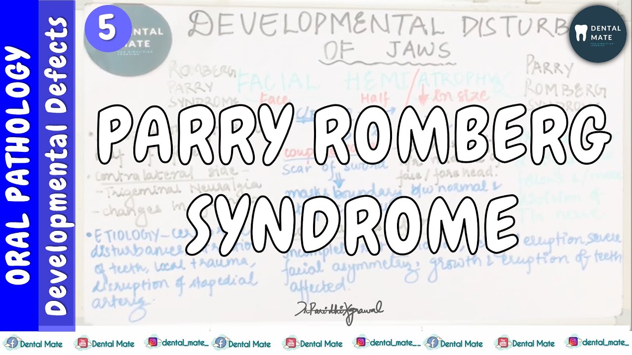 Parry Romberg Syndrome | Facial Hemiatrophy | Romberg Parry syndrome ...