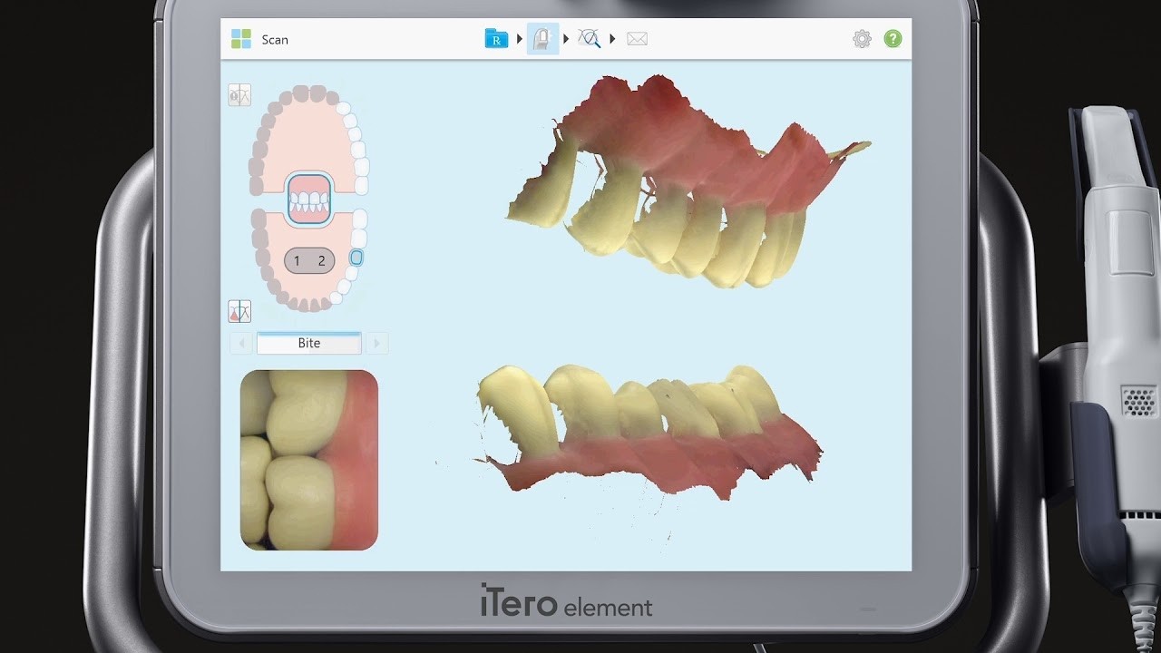 iTero® Scanner Tutorial: Pre-Treatment Scan - YouTube