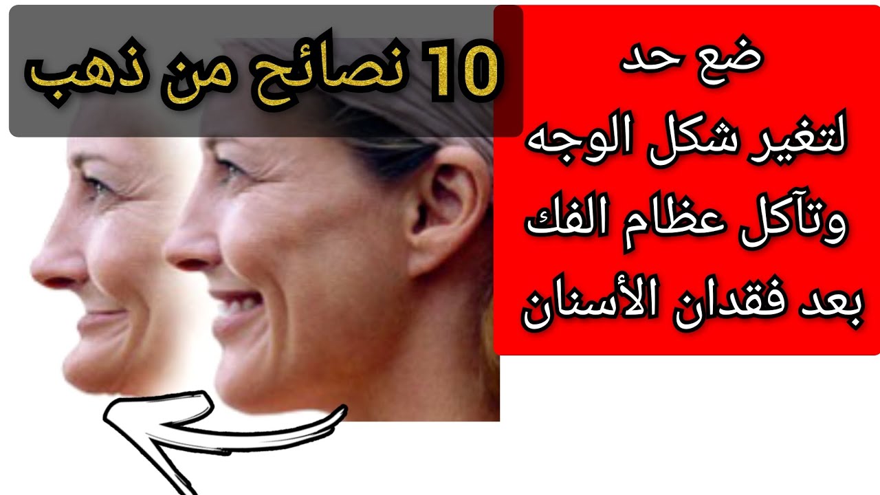 كيفية وقف تغير شكل الفم و الوجه بعد فقدان الأسنان بسبب تآكل و ضمور عظام