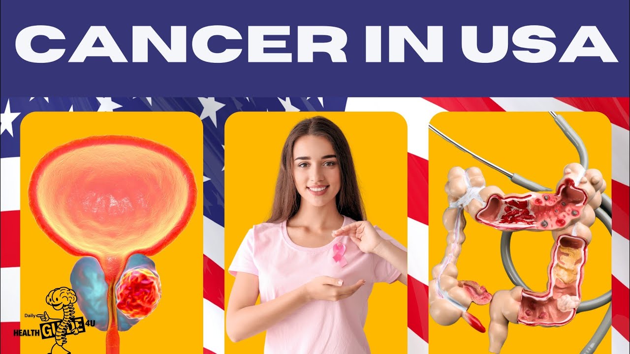 Top 5 Most Common Cancers In The Usa Signs And Prevention Youtube