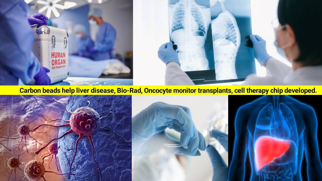 Carbon beads help liver disease, Bio-Rad, Oncocyte monitor transplants ...