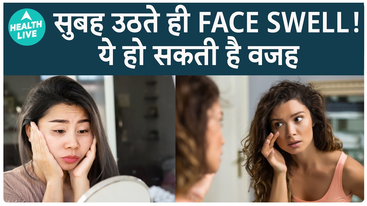 Facial Swelling in Morning : Here’s why? | How to get rid of Morning ...