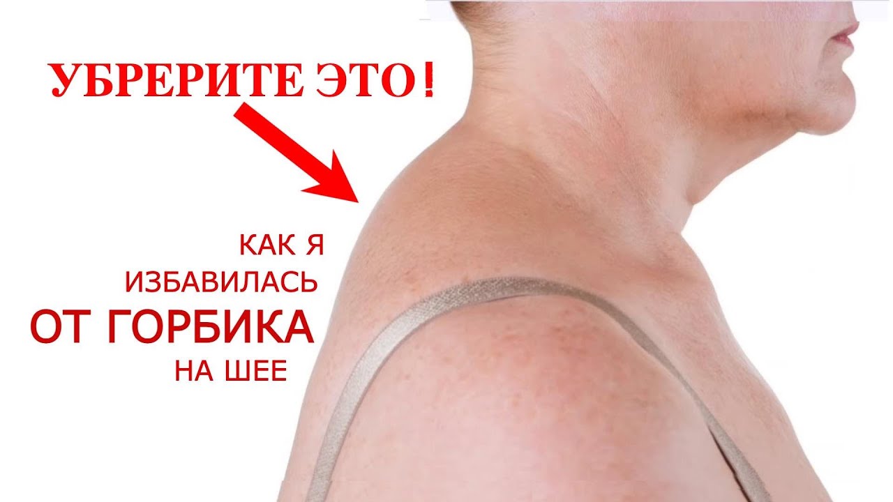 За 5 минут избавиться от ОТ ХОЛКИ. Жаль что раньше этого не знала ...