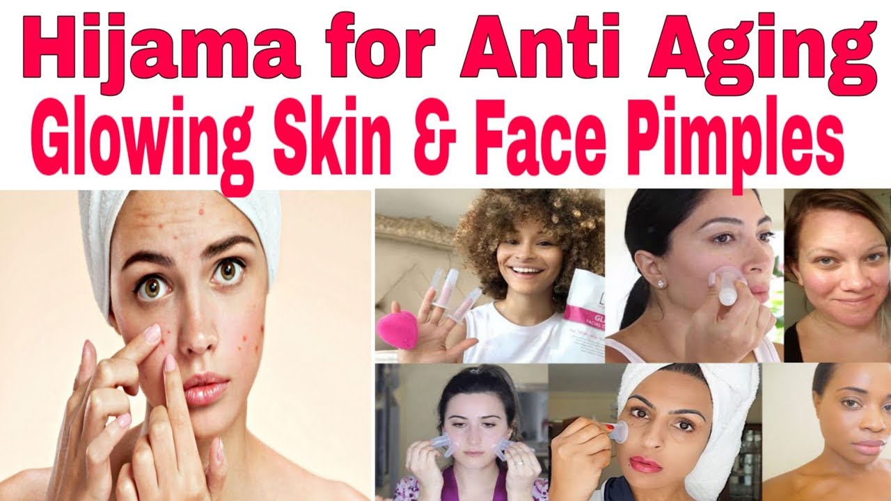 Hijama For Anti Aging & Glowing Skin / Face Pimples And Acne Ep 25 ...