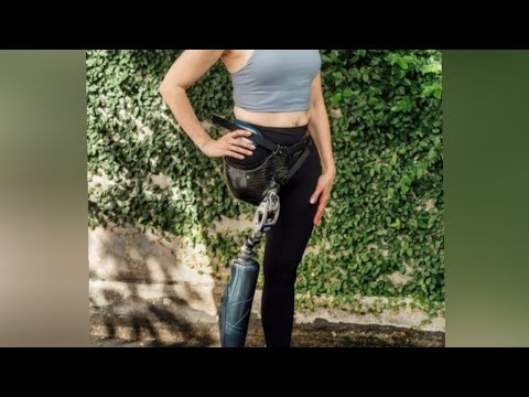 The beautiful woman with a leg amputee challenges disability, is ...
