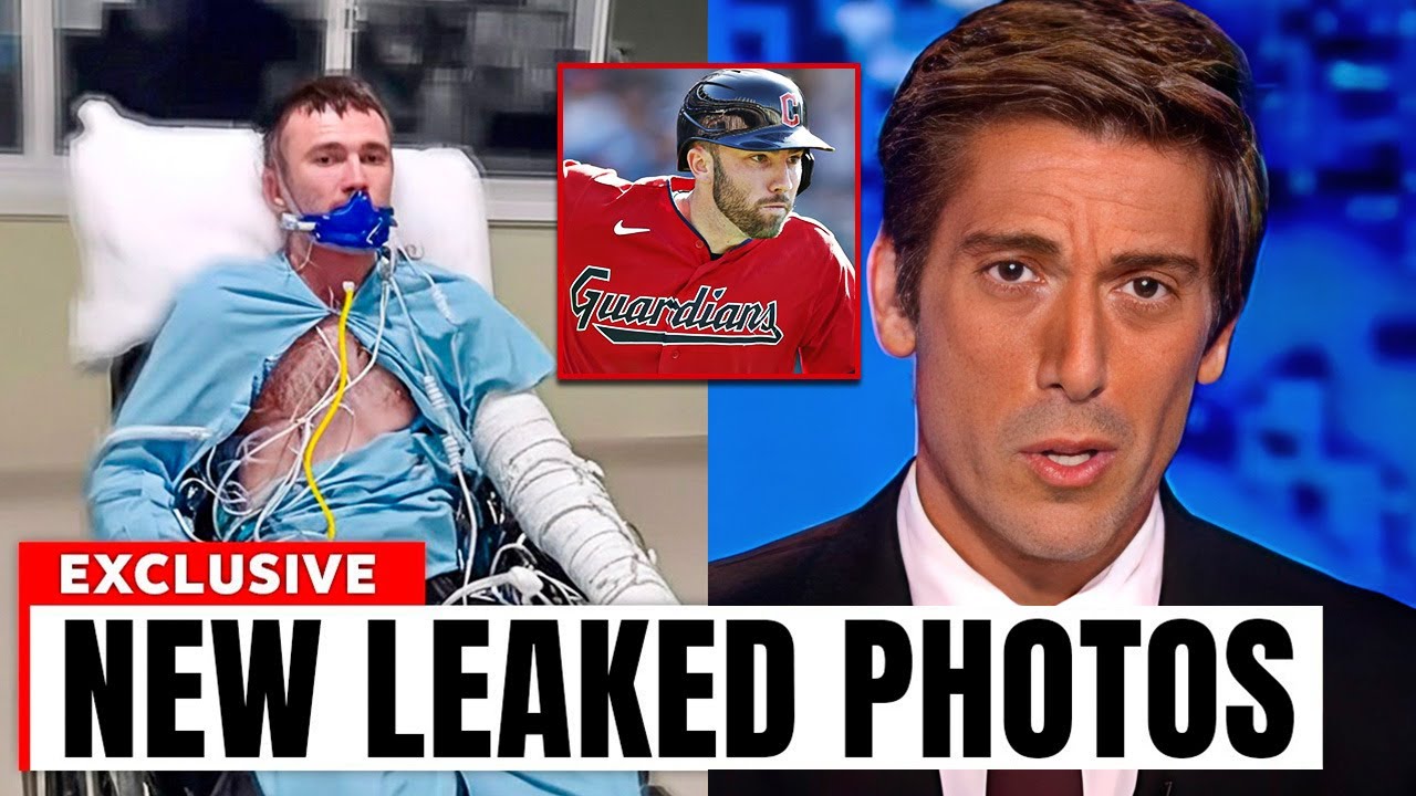 David Fry is Out of The Hospital After His Injury, How He Lives is Sad ...