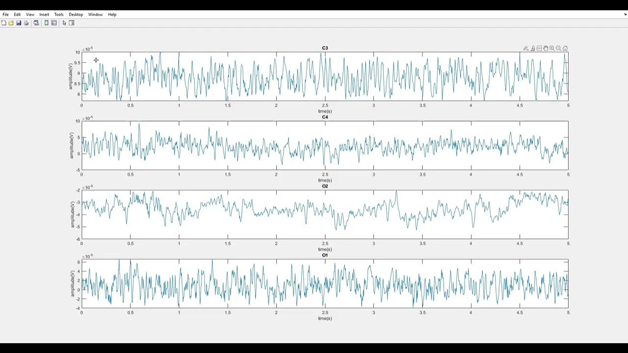 LAB 1 MATLAB EEG SIGNALS PLOTTING - YouTube