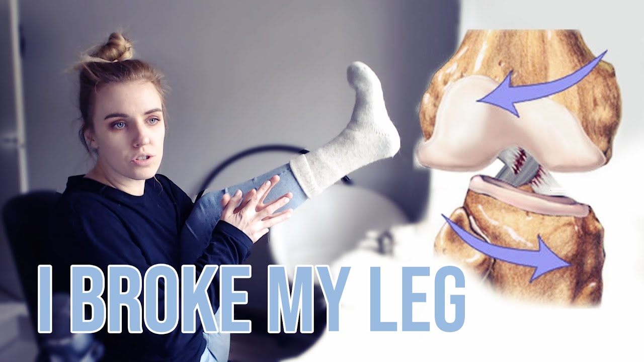 i broke my leg - YouTube