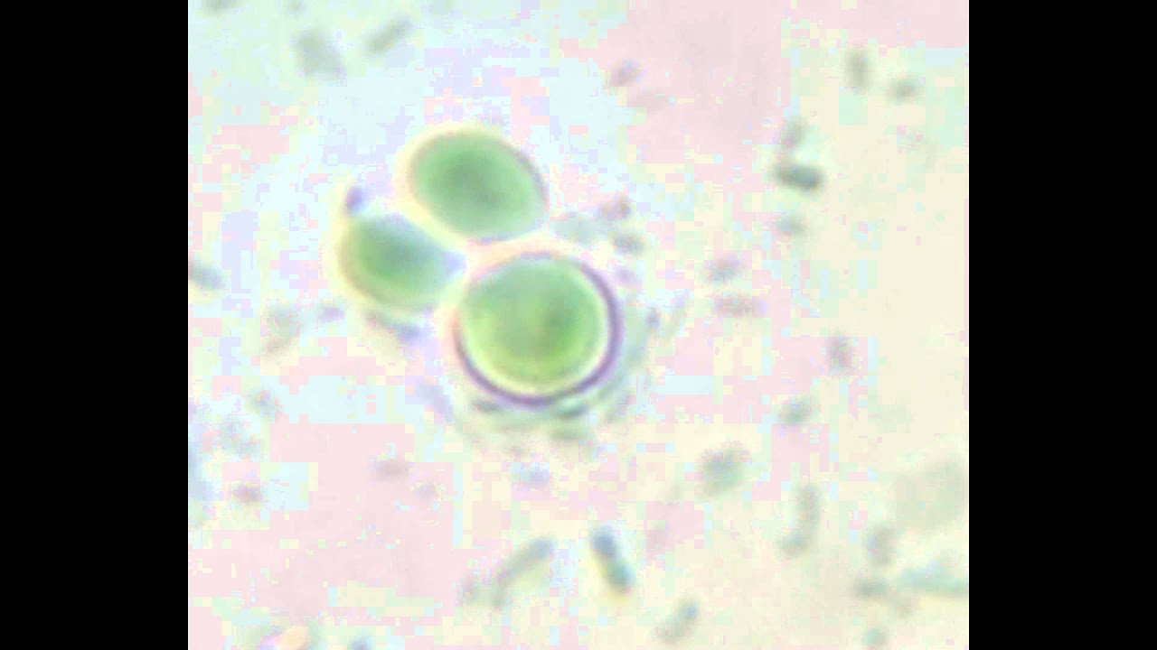 Time lapse video of bacteria - YouTube