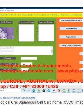 Histopathological Oral Squamous Cell Carcinoma (OSCC) image classification matlab code - YouTube