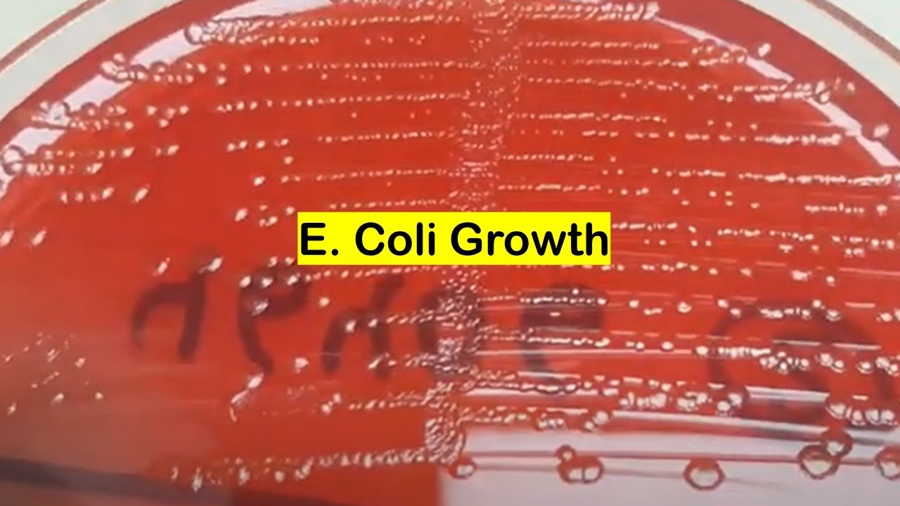E. coli Colony Morphology - YouTube