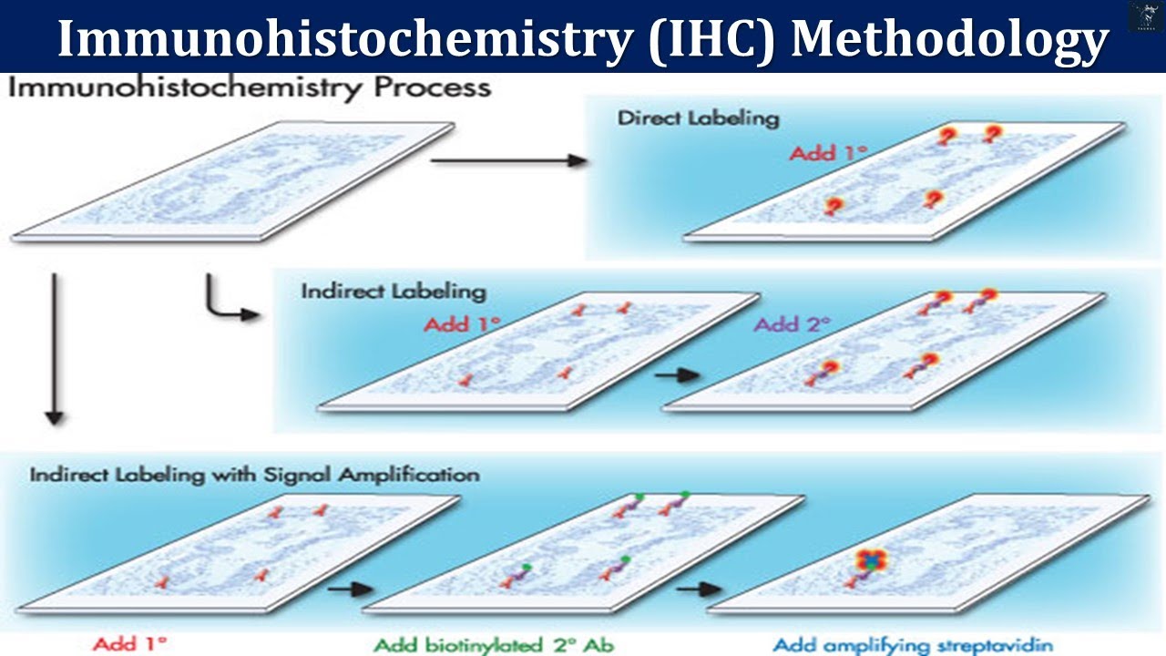 Immunohistochemistry (IHC) Methodology | Principle and Key Steps in ...