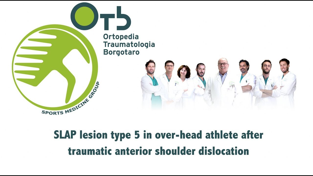 Arthroscopic treatment for SLAP lesion Type 5_Trattamento artroscopico ...