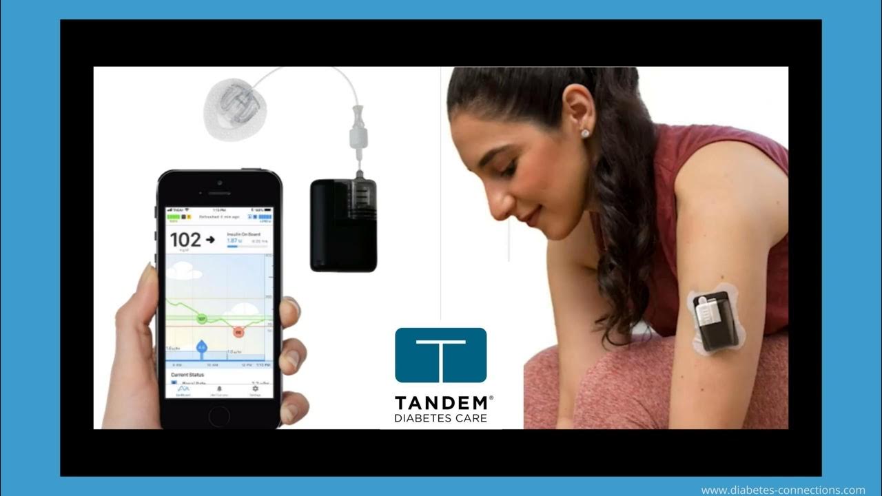 Smaller, Smarter, & More Flexible: A look into Tandem's product ...