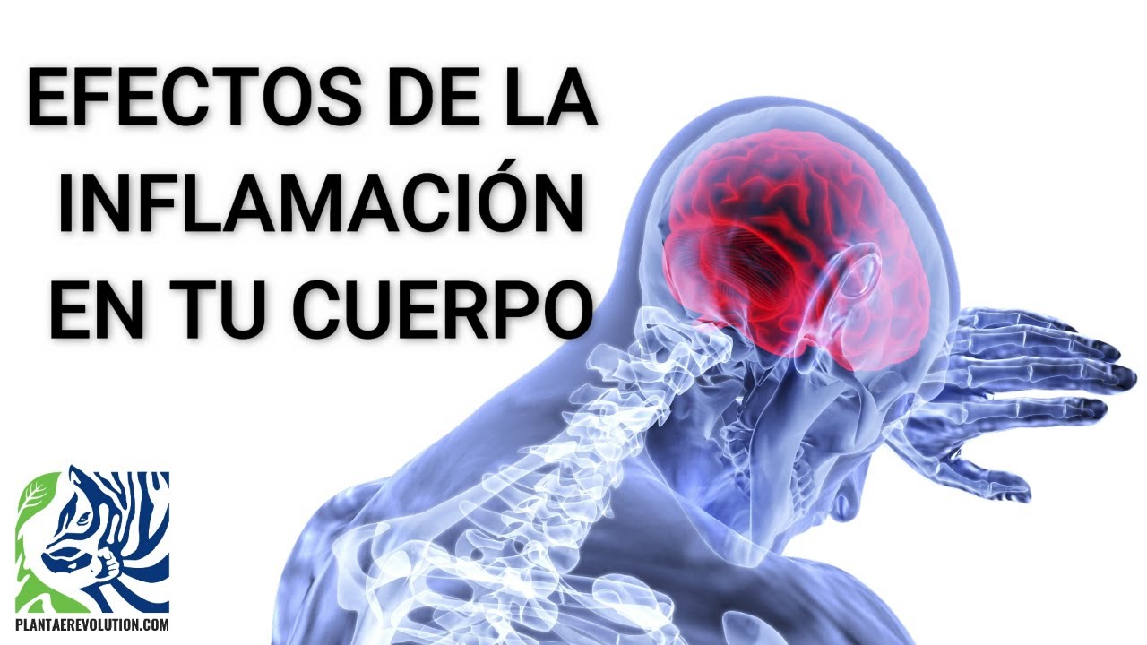 ASÍ AFECTA LA INFLAMACIÓN A NUESTRO CUERPO | PR 482 - YouTube