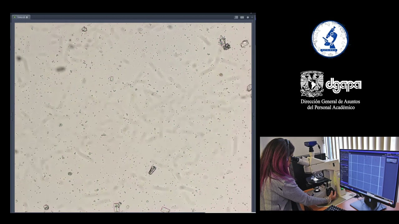 PRÁCTICA 15. EXAMEN MICROSCÓPICO DE LA ORINA. - YouTube