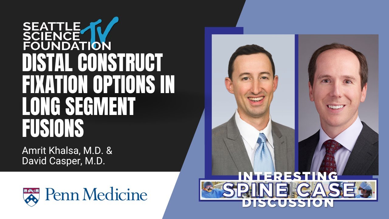 Distal Construct Fixation Options in Long Segment Fusions - David ...