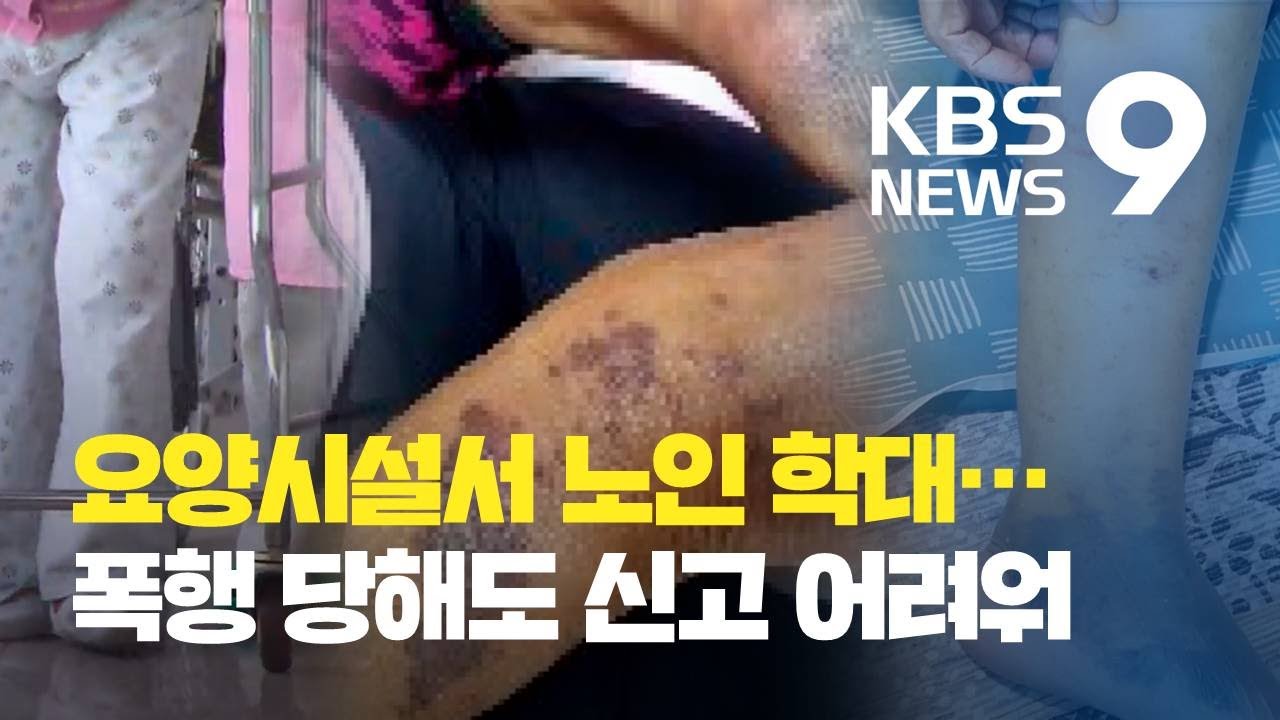 가려진 ‘노인 학대…요양원 등 복지시설 학대 늘어 Kbs뉴스 News Youtube