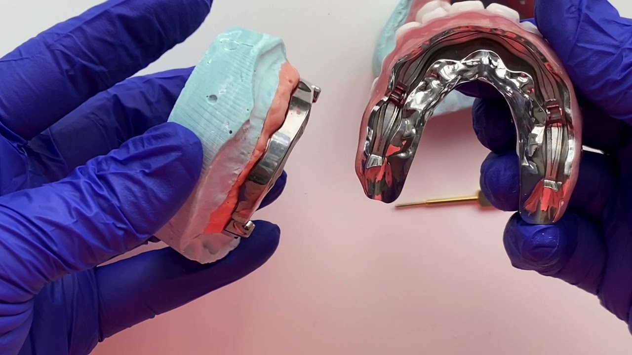 ReBourke - Implant Retained Dentures - Removable Implant Denture option ...