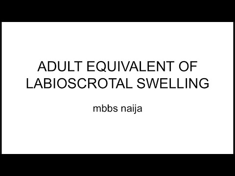 Adult Equivalent of Labioscrotal swelling in male and Female - YouTube