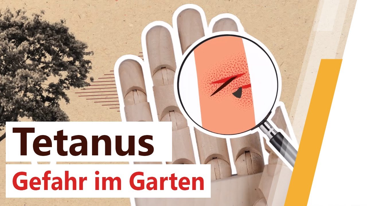 Tetanus-Infektionen: Verlauf, Behandlung, Vorsorge durch Impfung - YouTube