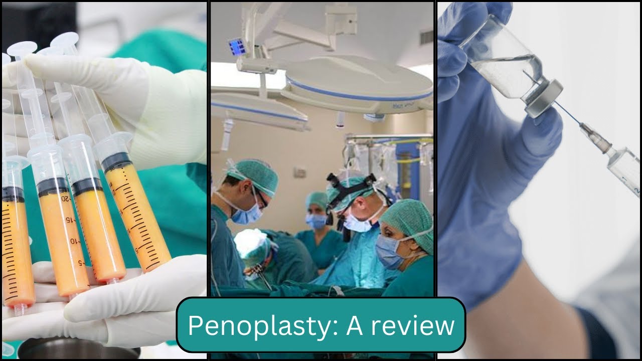 Penoplasty Uncovered: The Best Method for Maximum Length? - YouTube