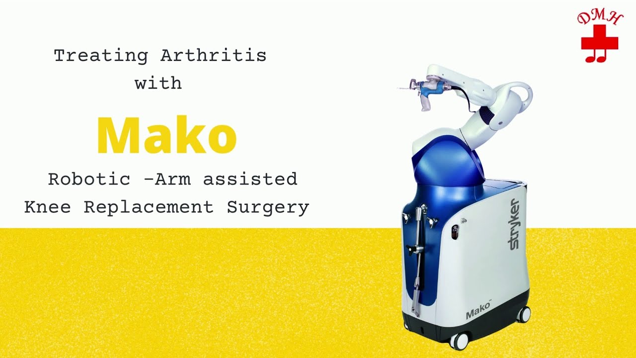 Knee Replacement surgery with MAKO Robotic arm. - YouTube