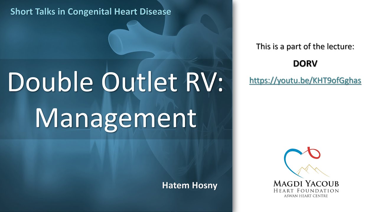 DORV: Management - Hatem Hosny - YouTube