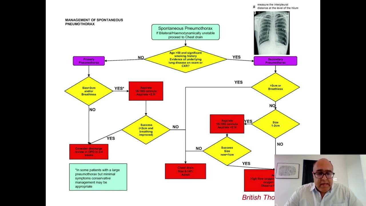Y3 Resp Med Virtual Ward Round Case 2 - YouTube