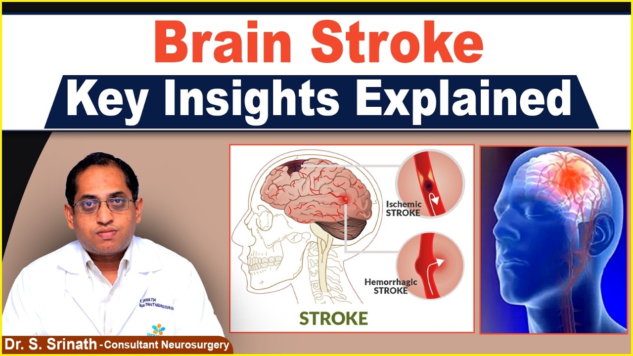 How to Treat Brain Stroke for Better Recovery || Causes and Symptoms of ...