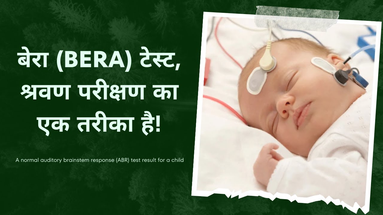 "What is BERA Test? Comprehensive Overview for Hearing Diagnosis - YouTube