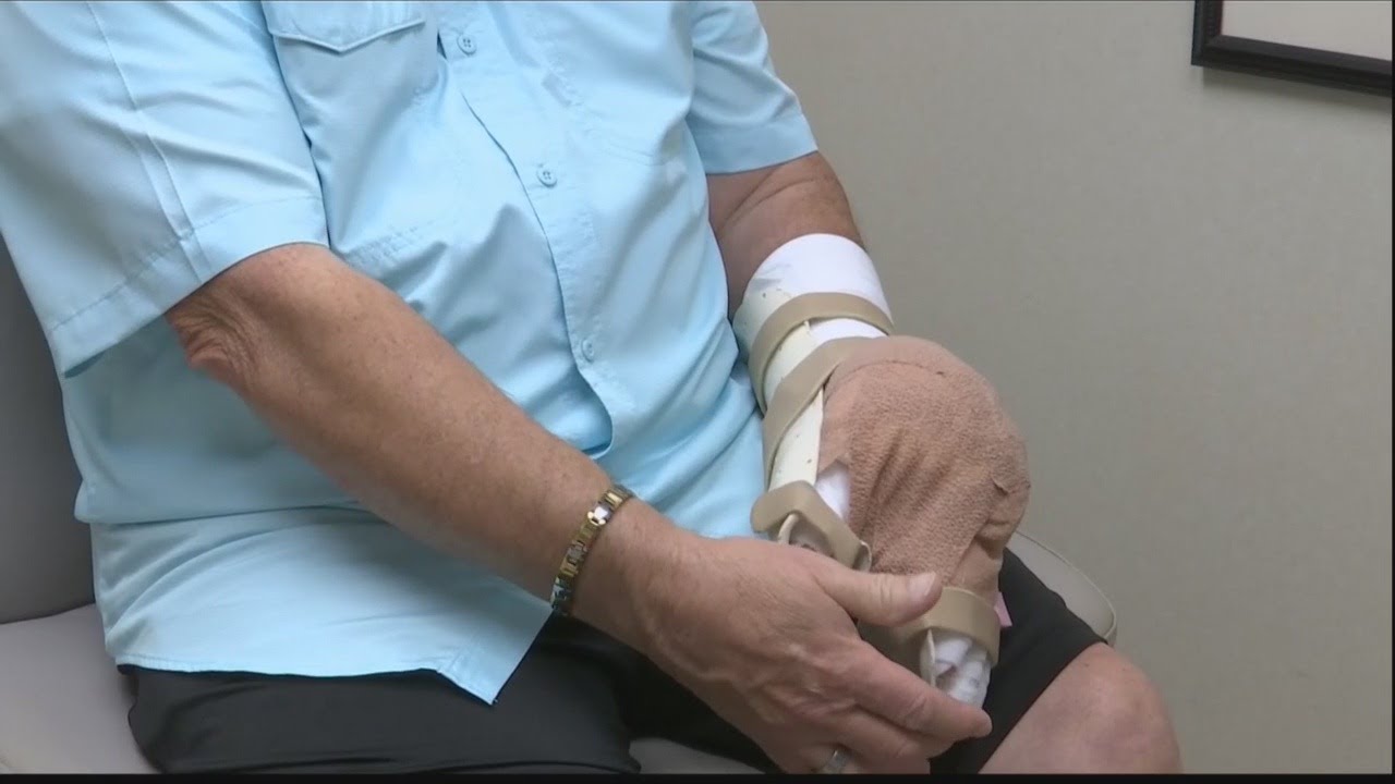 Memorial Health surgeons save man's hand by attaching it to groin area ...