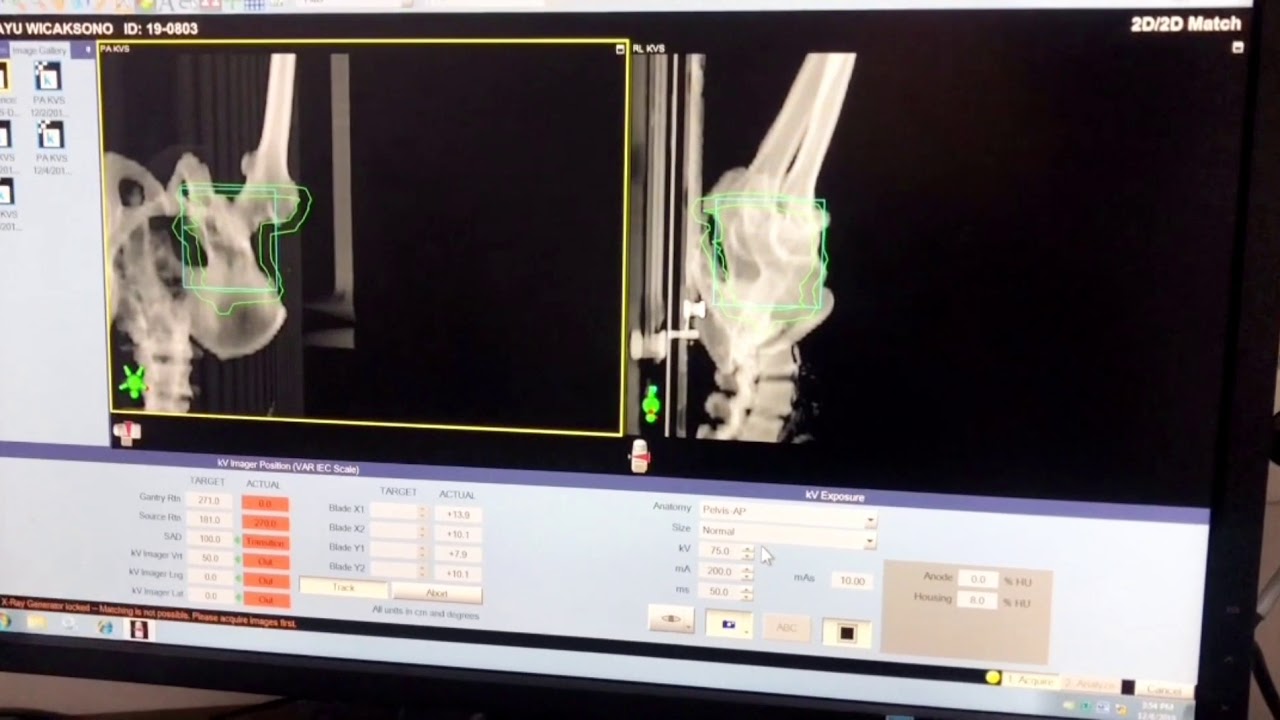 ON BOARD IMAGER - TUGAS VIDEO #PKLRADIOTHERAPYMRCCC - YouTube