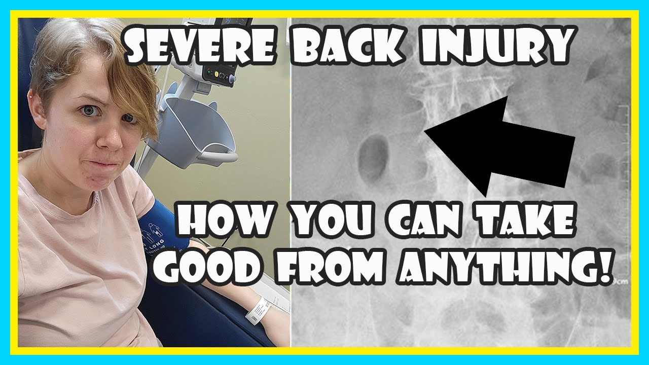 6 Powerful Life Lessons I Learned From Severe Back Injury - YouTube
