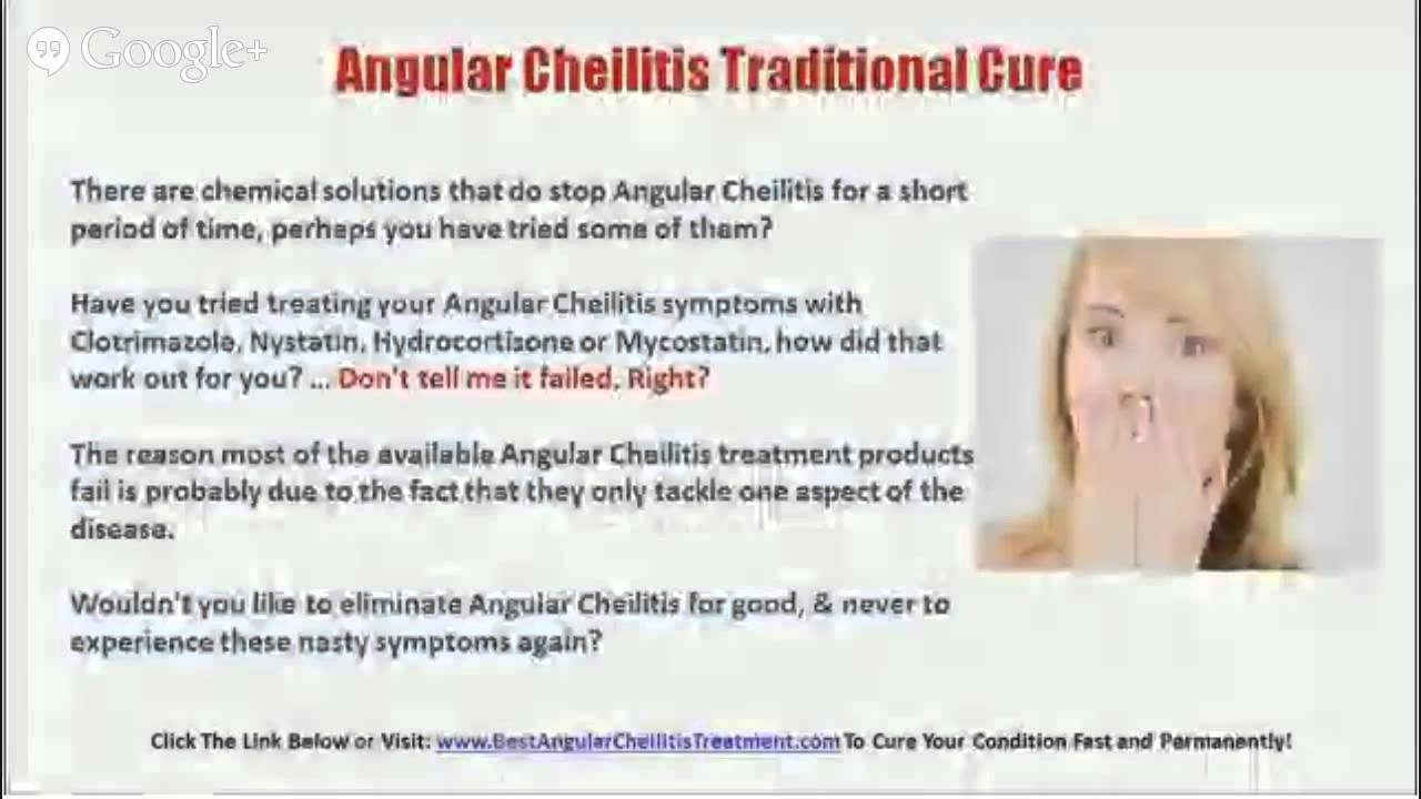 Curing Angular Cheilitis - Natural Angular Cheilitis Remedy - YouTube