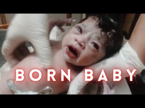 new born baby// born baby suction. - YouTube