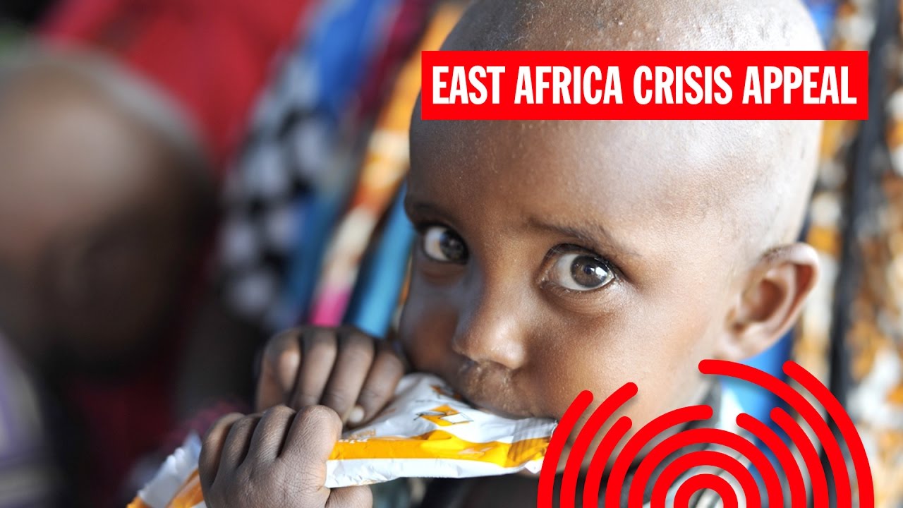 What is Plumpy'Nut? - YouTube