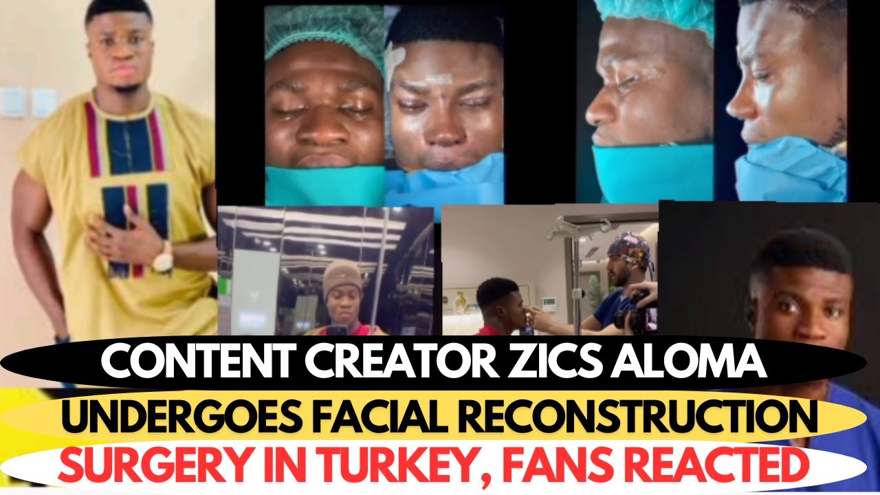 Content Creator And Influencer, ZICS ALOMA Undergoes Facial Plastic ...