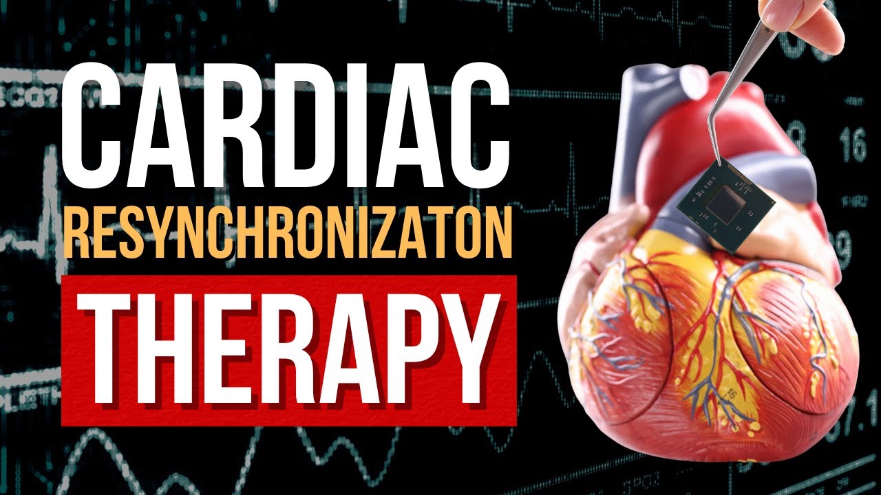 The Power of Cardiac Resynchronization Therapy (CRT) | This Is How CRT ...