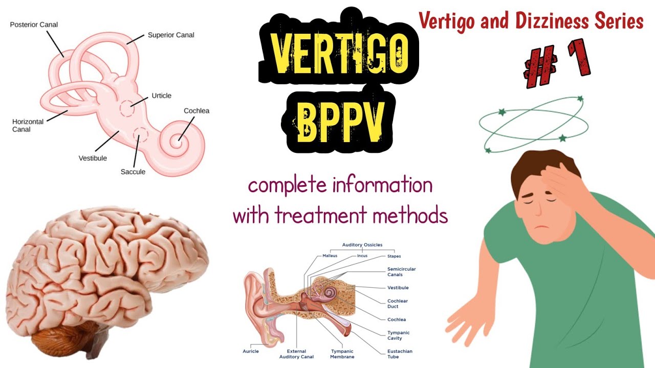 BPPV Treatment in Hindi | ear disease | Vertigo | Dizziness | BPPV ...