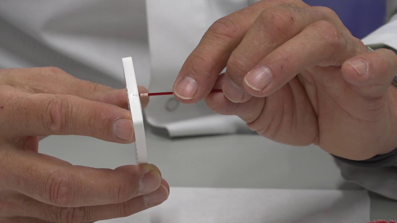 Hematocriet inzetten volgens de Gouden standaard - YouTube