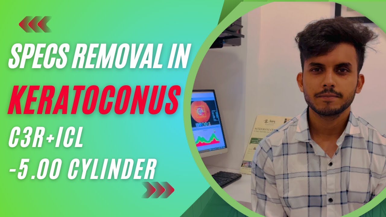 SPECS REMOVAL SURGERY EXPERIENCE| KERATOCONUS| C3R & ICL | NETRAM - YouTube