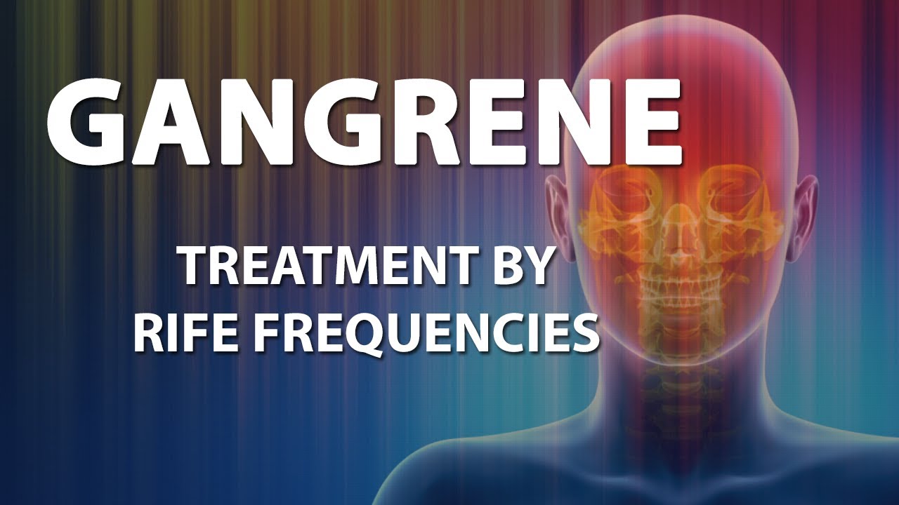 Gangrene - RIFE Frequencies Treatment - Energy & Quantum Medicine with ...